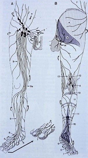 Lymphedema Diagram